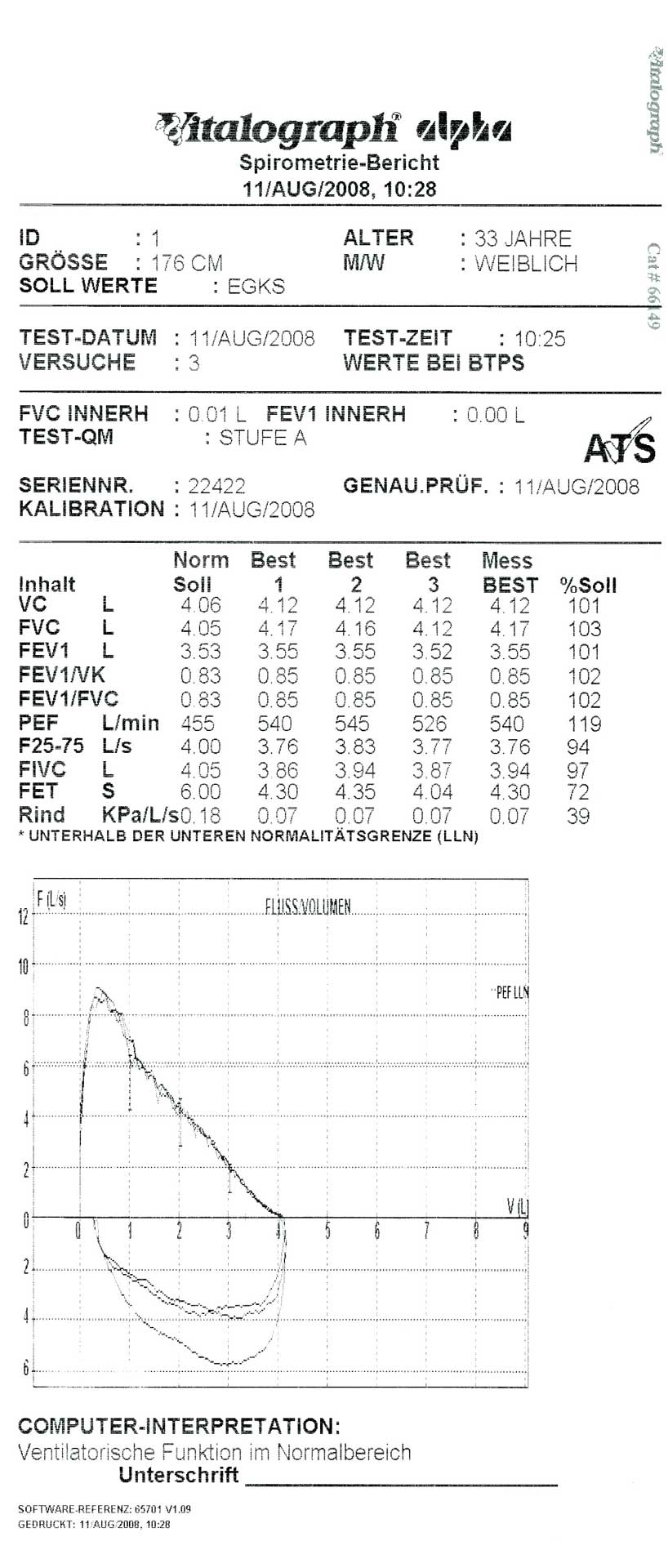 Spirometry paper, roll for alpha V, Compact II, original | Fleischhacker